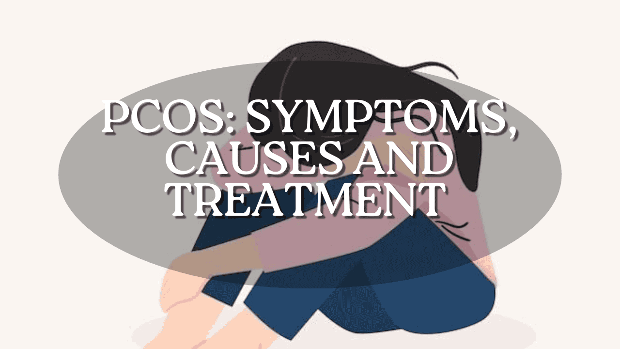 What is PCOS? Causes, symptoms and treatment